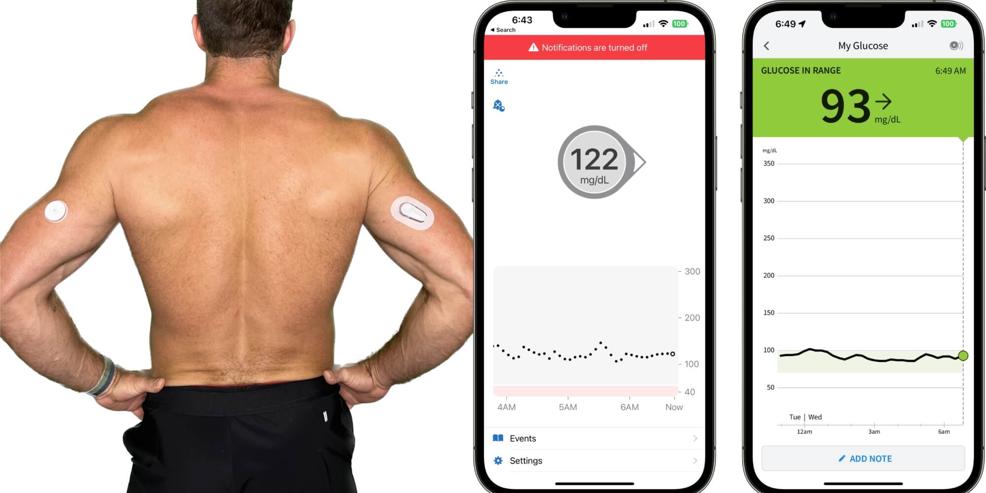 Dexcom Vs Freestyle Libre Hands On Review And Comparison